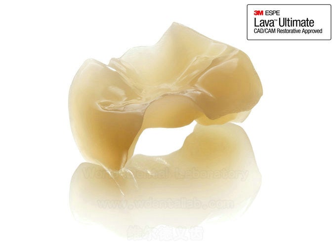 "3M Lava Ultimate(라바 얼티메이트)" : 네이버 블로그