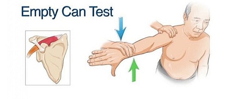 극상근supraspinatus 가시위근 해부학 회전근개 운동 스트레칭 어깨 회전근개파열 어깨충돌증후군 네이버 블로그