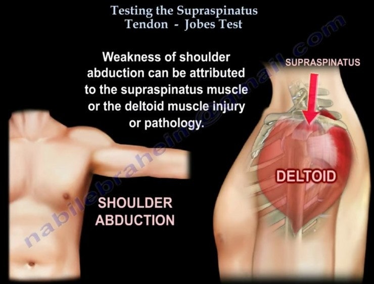 극상근supraspinatus 가시위근 해부학 회전근개 운동 스트레칭 어깨 회전근개파열 어깨충돌증후군 네이버 블로그