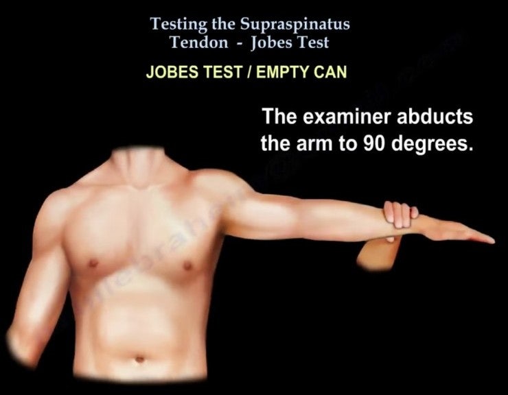 극상근supraspinatus 가시위근 해부학 회전근개 운동 스트레칭 어깨 회전근개파열 어깨충돌증후군 네이버 블로그