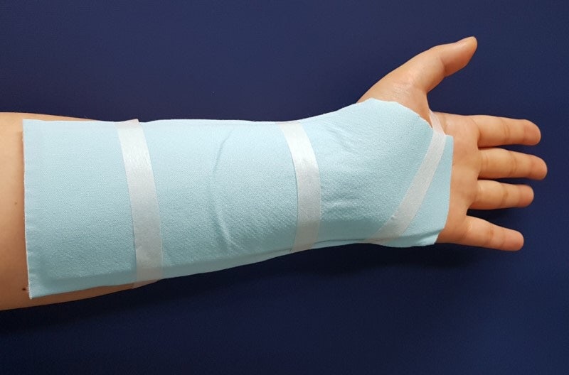 Short Arm Splint : 네이버 블로그