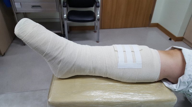 Short Leg Splint : 네이버 블로그