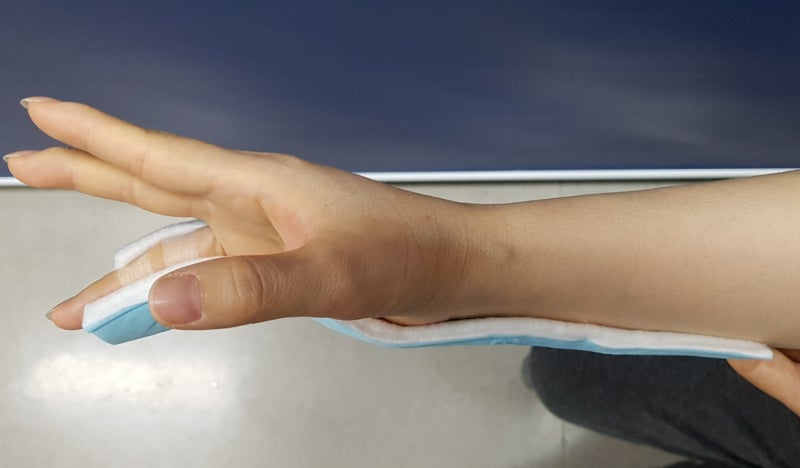 Short Arm Ulnar Gutter Splint : 네이버 블로그