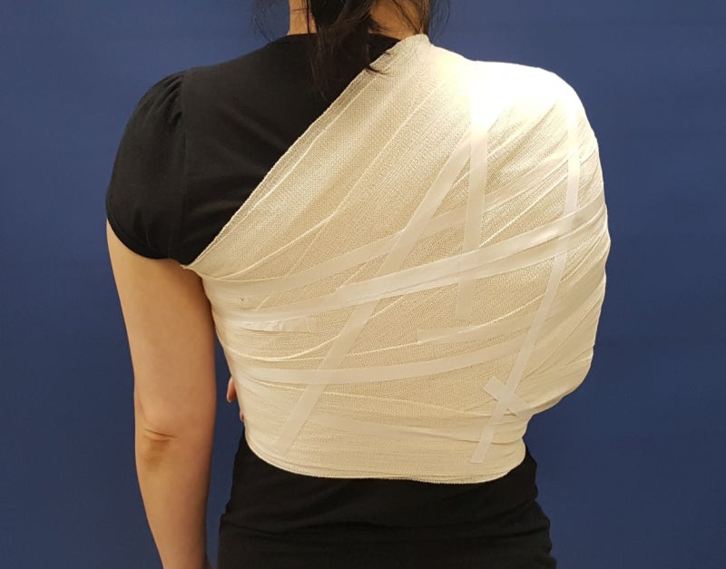 Velpeau Bandage : 네이버 블로그