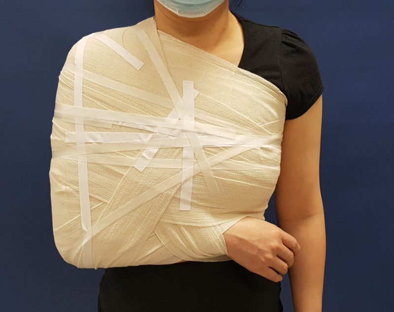 Velpeau Bandage : 네이버 블로그