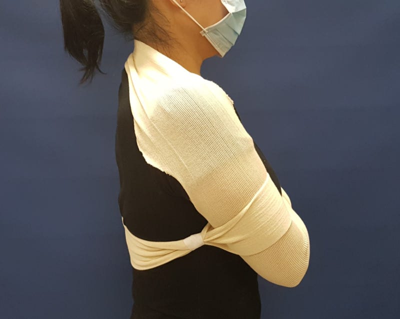 Stockinette Velpeau : 네이버 블로그