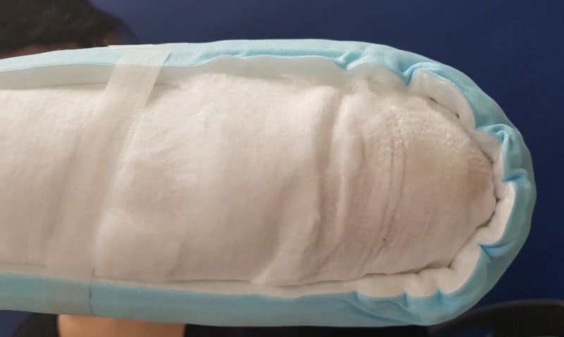 Sugar Tong Splint : 네이버 블로그