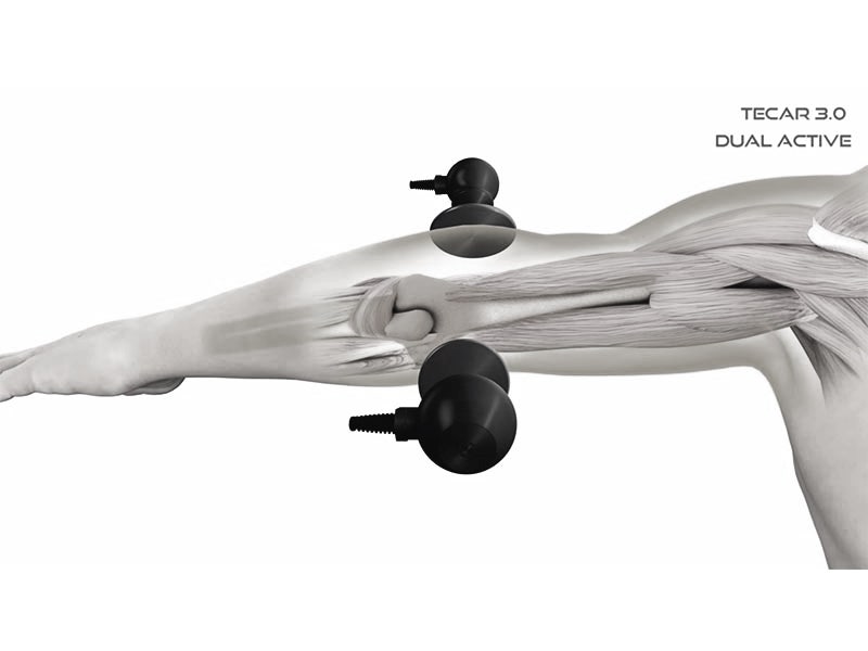 윈백WINBACK_윈백 테카테라피 (TECAR3.0) : 네이버 블로그