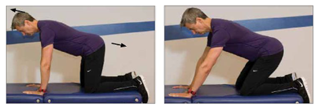 scapular downward rotation syndrome(견갑골 하방 회전 증후군) 원인 및 치료 - 정형외과 환자 교육 ...