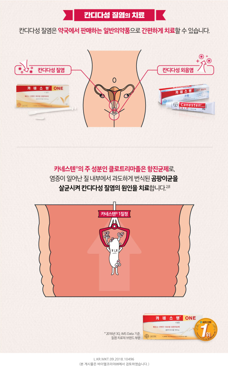 칸디다성 외음염 간편하게 카네스텐®크림으로 치료해요 네이버 블로그