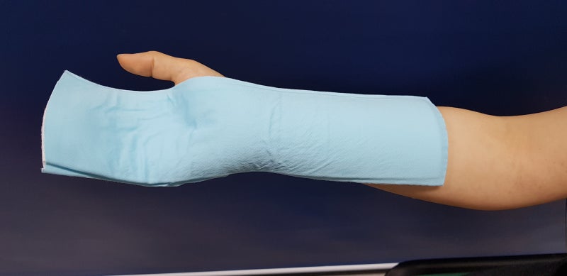 Short Arm Splint : 네이버 블로그