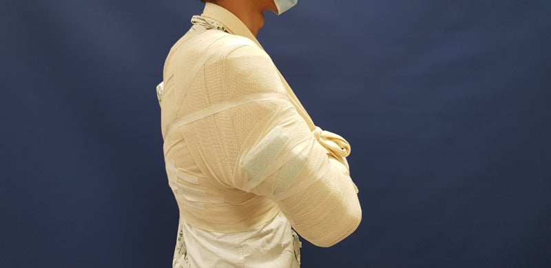 U-Slab Splint : 네이버 블로그