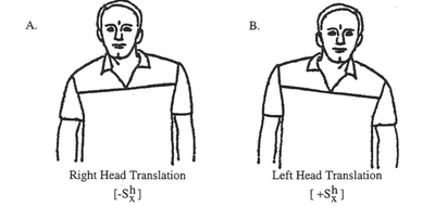 얀다의 근육불균형의 평가와 치료(Assessment and Treatment of Muscle Imbalance The ...