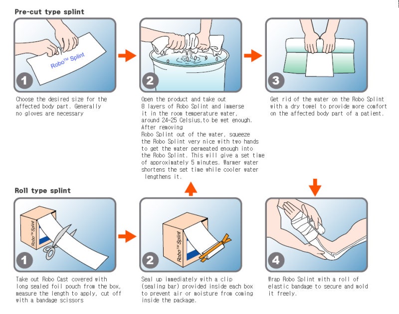 [S&F] 로보 롤스프린트 (Robo Roll Splint) : 네이버 블로그