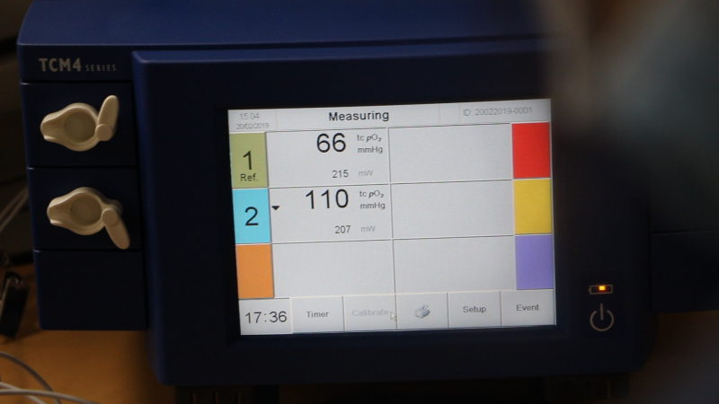 아이벡스메디칼시스템즈) TCM400 - TCPO2 교육 : 네이버 블로그