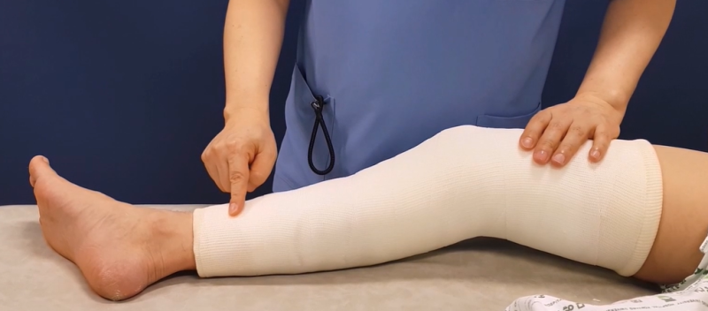 Cylinder Cast : 네이버 블로그