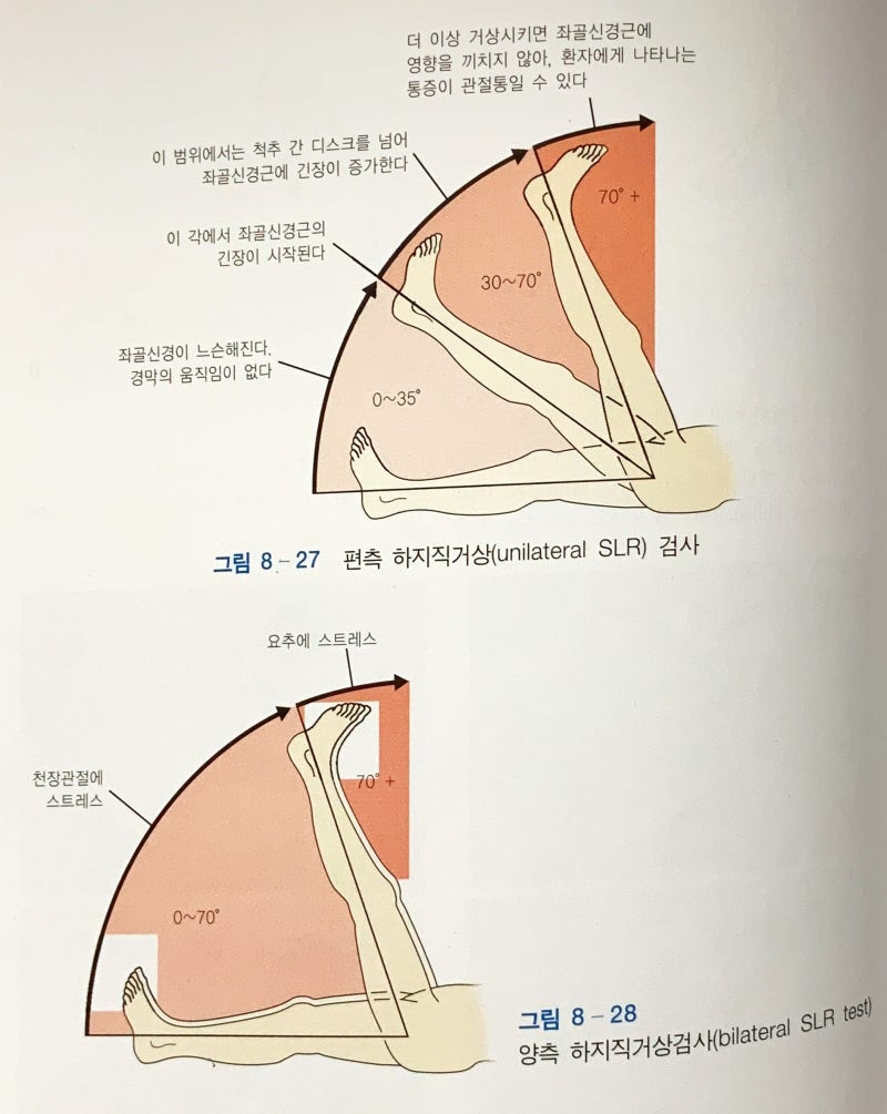 하지직거상 검사에 대해서 : 네이버 블로그