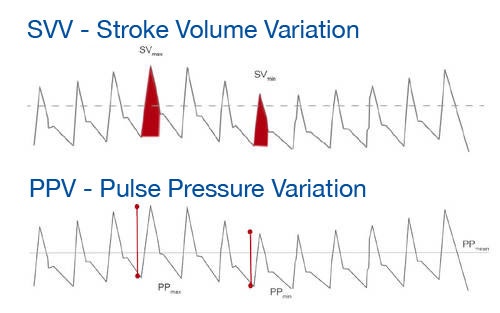 PPV (Pulse Pressure Variation) : 네이버 블로그