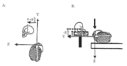 얀다의 근육 불균형의 평가와 치료(Assessment and Treatment of Muscle Imbalance The ...
