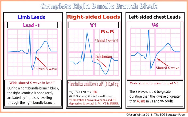 핵심기본간호술기 열여섯번째 : 말초 산소포화도 측정, 심전도(EKG) 모니터 적용 / 이론편 : 네이버 블로그