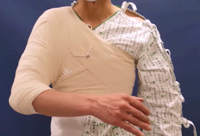 U-Slab Splint : 네이버 블로그