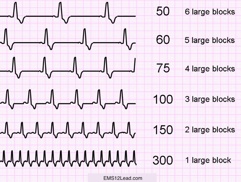 ecg-rr-heart-rate