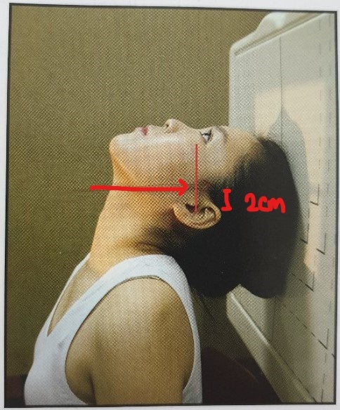 skull submentovertical projection = Schuller법(skull) : 네이버 블로그