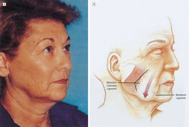 얼굴의 지지 인대 'Facial retaining ligament' : 네이버 블로그