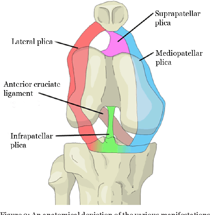 [성신여대한의원]추벽증후군(Plica syndrome) : 네이버 블로그