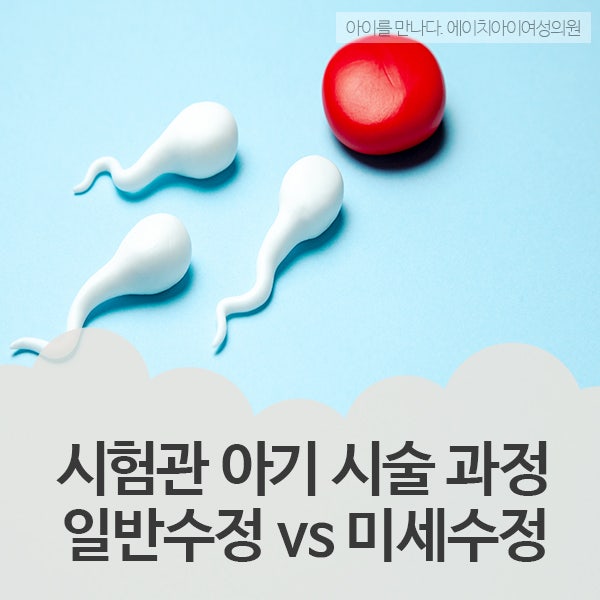 시험관 아기 시술 과정 일반수정 Vs 미세수정 네이버 블로그