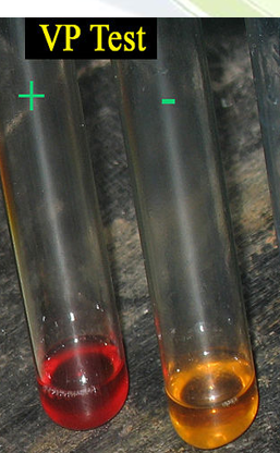Voges Proskauer (VP) Test Principle, Procedure, Results, 41% OFF