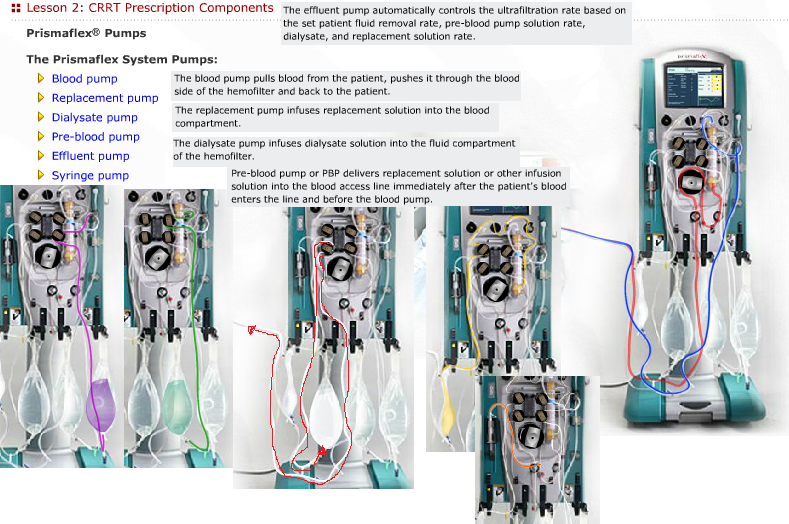 CRRT ; Contineous Renal Replacement Therapy : 네이버 블로그