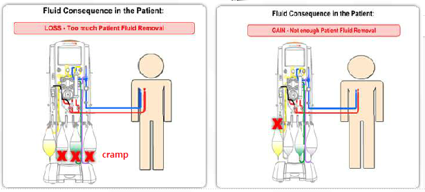 CRRT ; Contineous Renal Replacement Therapy : 네이버 블로그