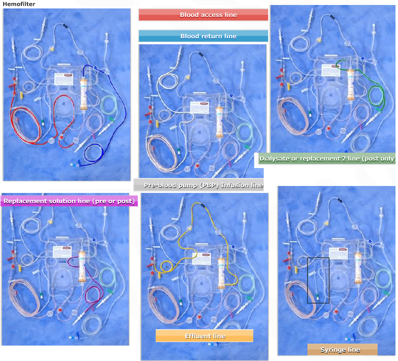 CRRT ; Contineous Renal Replacement Therapy : 네이버 블로그