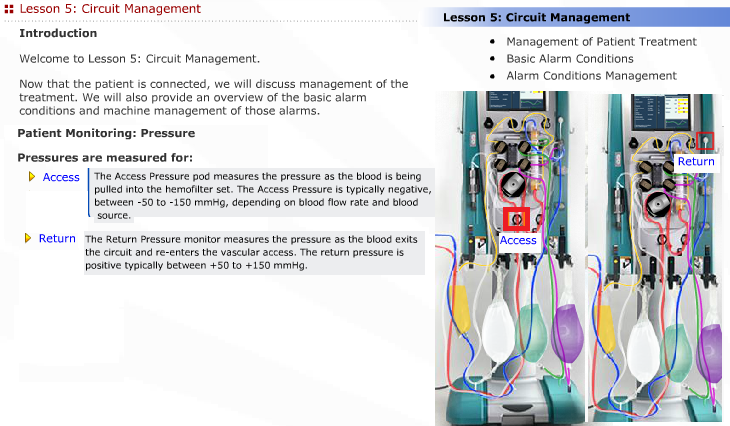 CRRT ; Contineous Renal Replacement Therapy : 네이버 블로그