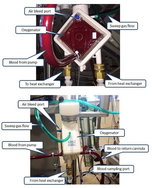 ECMO(ExtraCorporeal Membrane Oxygenator) - 체외막산소공급장치 총정리 : 네이버 블로그