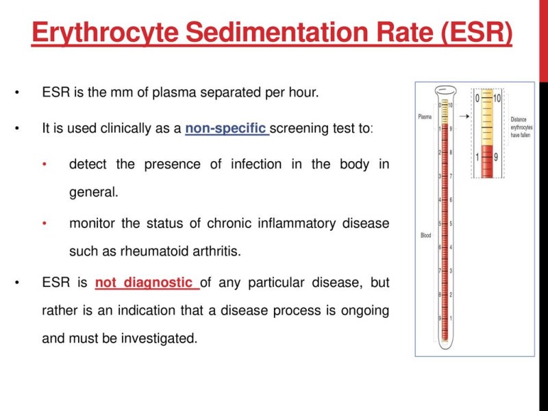 ESR 적혈구침강속도 검사(Erythrocyte Sedimentation Rate Test) : 네이버 블로그