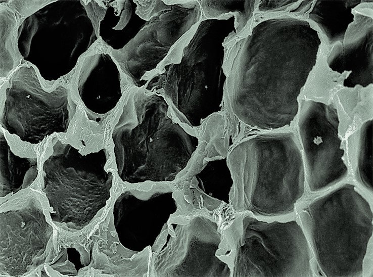 혈액형, 바이러스 그리고 질병 : 네이버 블로그