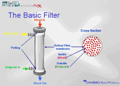 쉽게 이해하는 CRRT(Continuous Renal Replacement Therapy) : 네이버 블로그