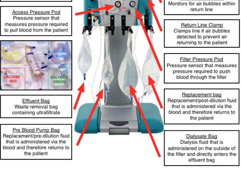 쉽게 이해하는 CRRT(Continuous Renal Replacement Therapy) : 네이버 블로그