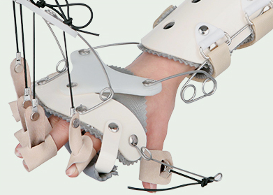 Dynamic Splint : 네이버 블로그