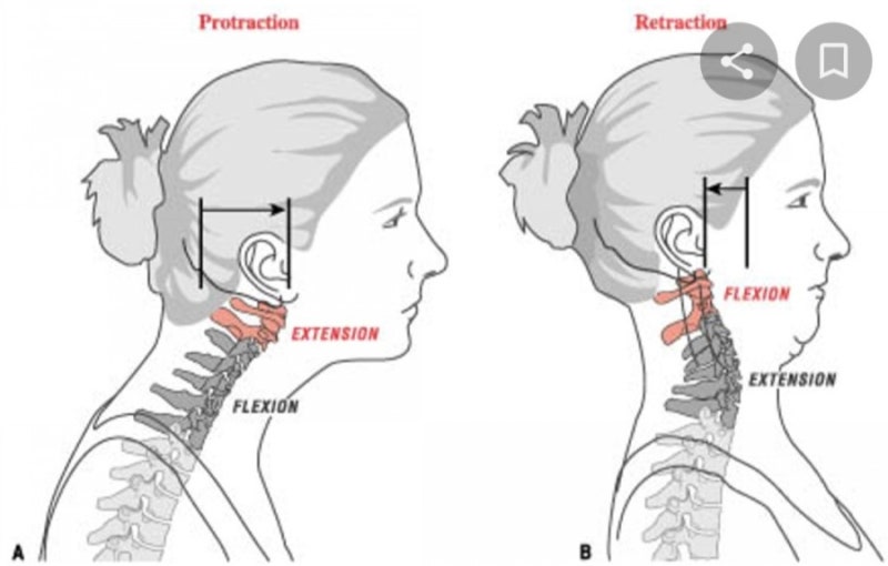 [소아재활]머리 들기&목 펴기(capital extension,cervical extension) : 네이버 블로그