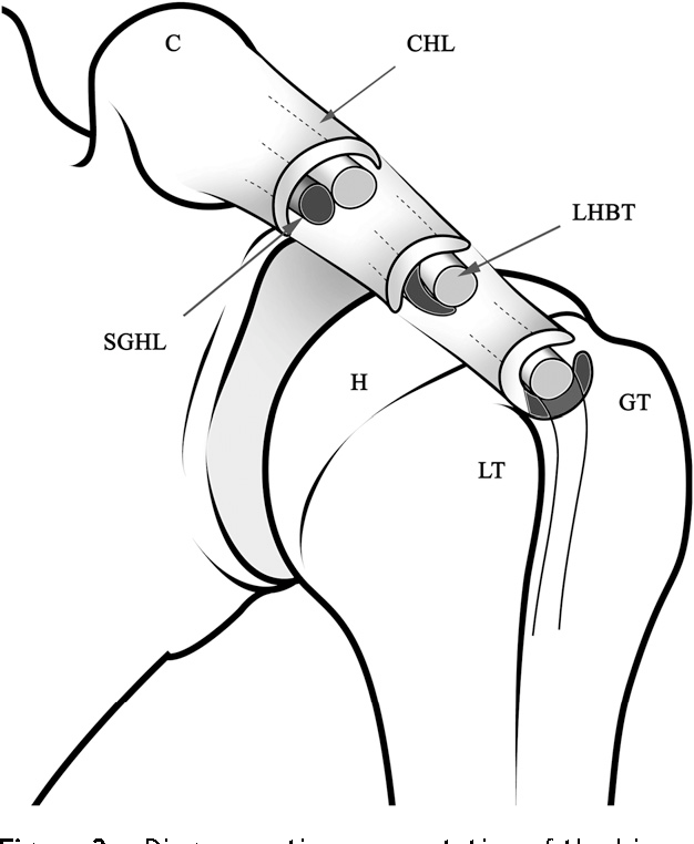 [통증/해부] Biceps pulley에 대한 고찰(유착성 관절낭염) : 네이버 블로그