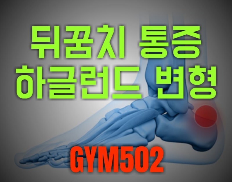 " 🔎발목 뒤꿈치 통증 : 하글랜드 변형 haglund deformity" 양산 물금 범어 증산 피티 재활 헬스 헬스장 ...