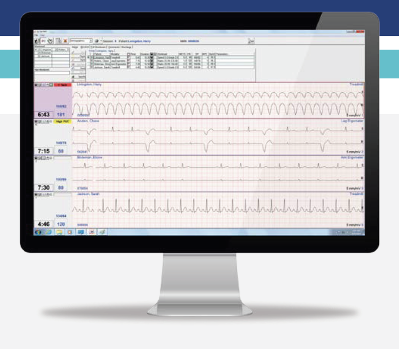 [심장재활] Cardiac Rehab Telemetry System : 네이버 블로그
