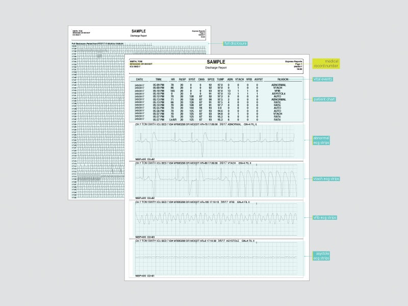 [심장재활] Cardiac Rehab Telemetry System : 네이버 블로그