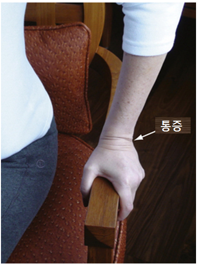 손목의 통증 3 삼각 섬유연골 복합체 Tfcc 손상 네이버 블로그