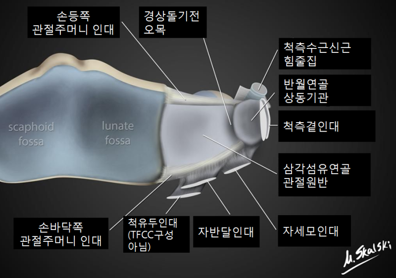 손목의 통증 3 삼각 섬유연골 복합체 Tfcc 손상 네이버 블로그