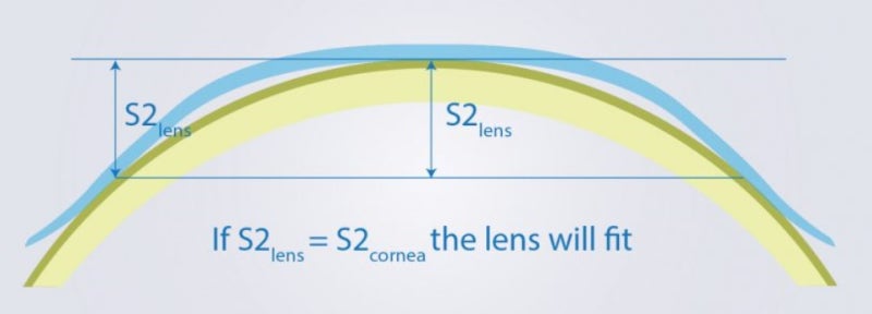 드림렌즈의 적당한 도수 결정은? : 네이버 블로그