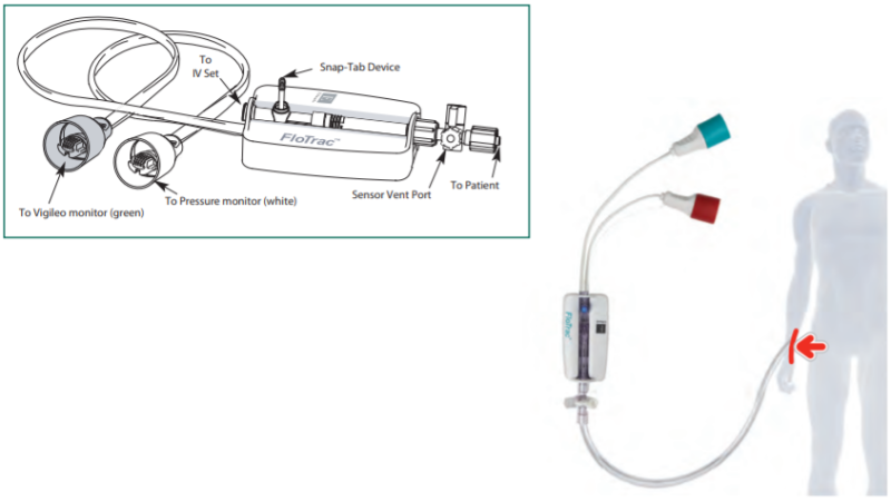 심장flow의 parameter. EV1000 - FloTrac sensor : 네이버 블로그